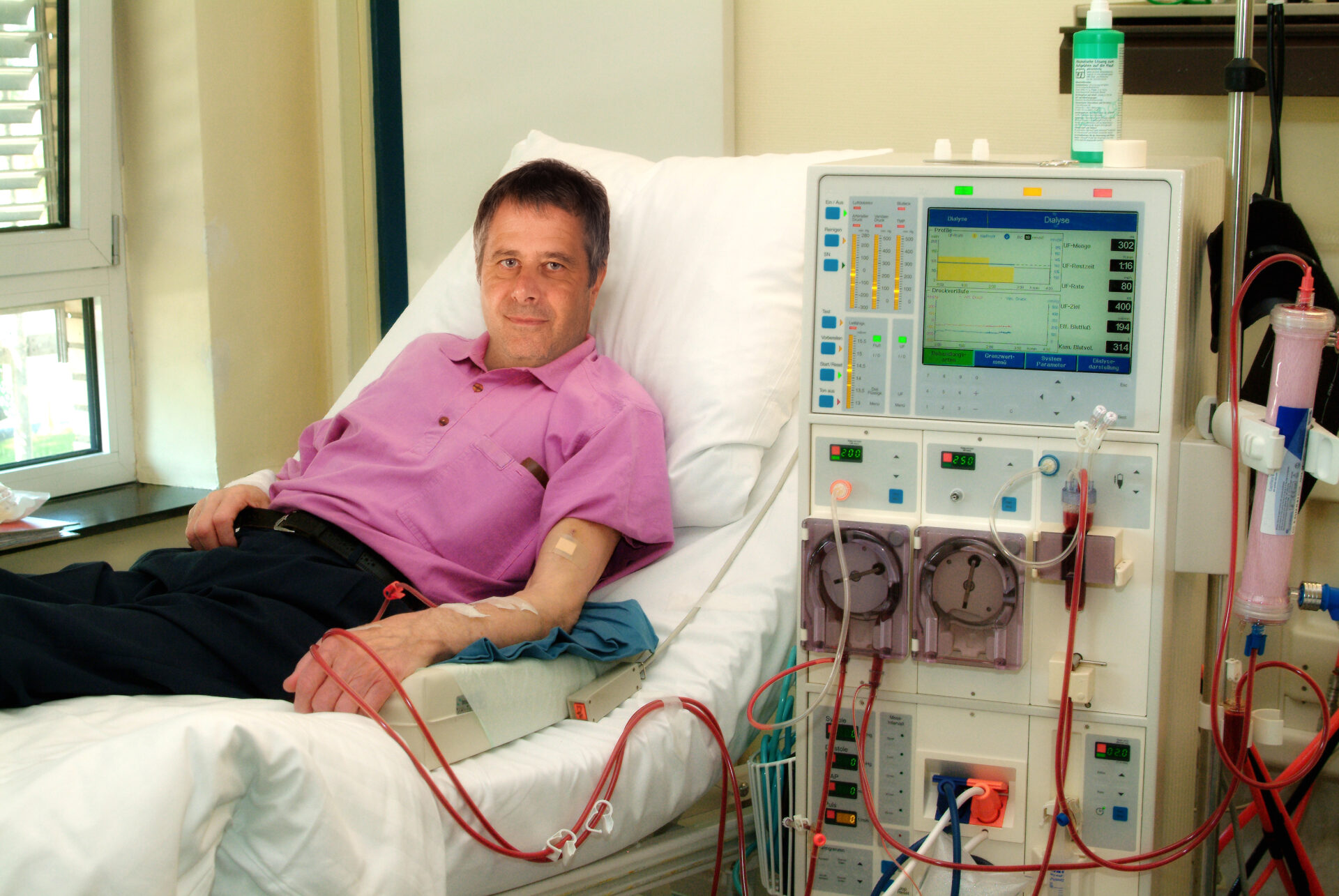 Dialysate: What’s in your Dialysis Bath? - The Hope