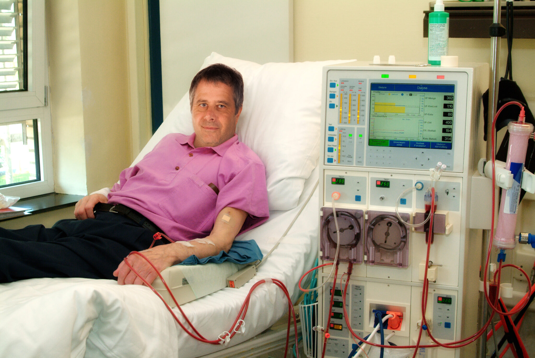 Dialysate: What’s in your Dialysis Bath? - The Hope