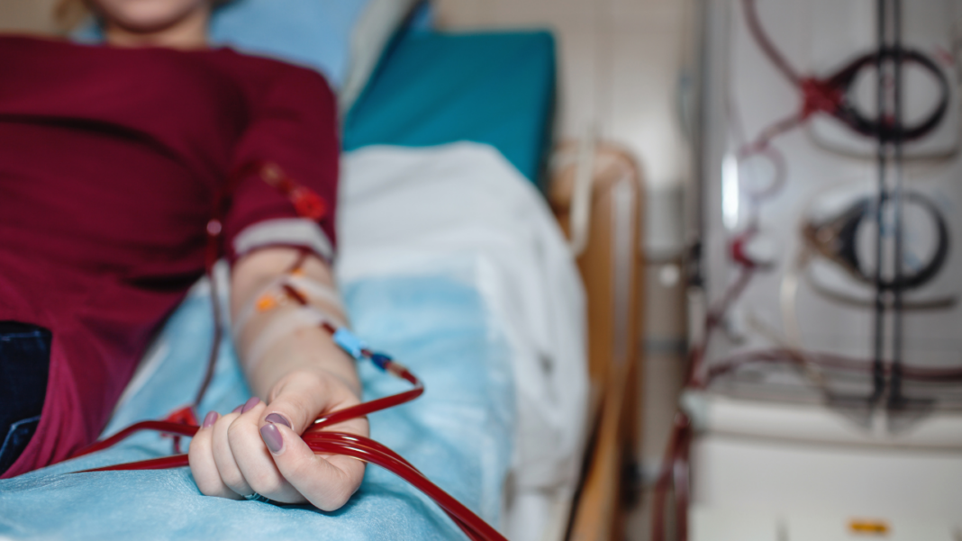 The Process of Receiving an AVF/AVG for new Hemodialysis Patients - The ...